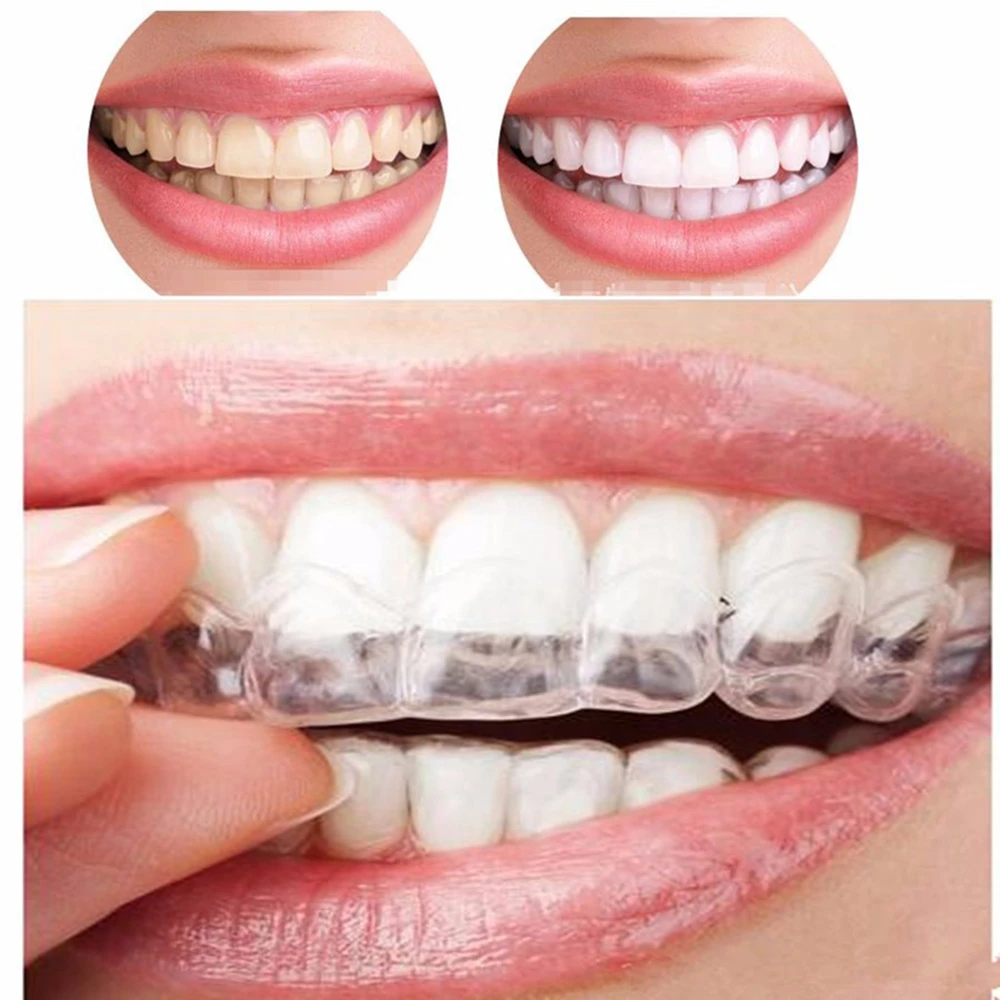 2021 4PCS Anti Snoring Bruxism Sleeping Mouth Guard Night Guard Gum ...