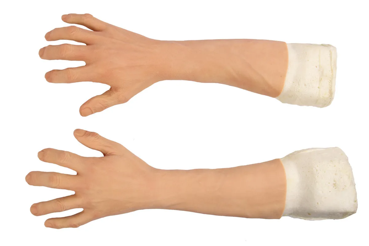 Prosthetic Arm Covers