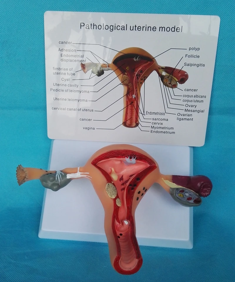 Uterus Model Labeled