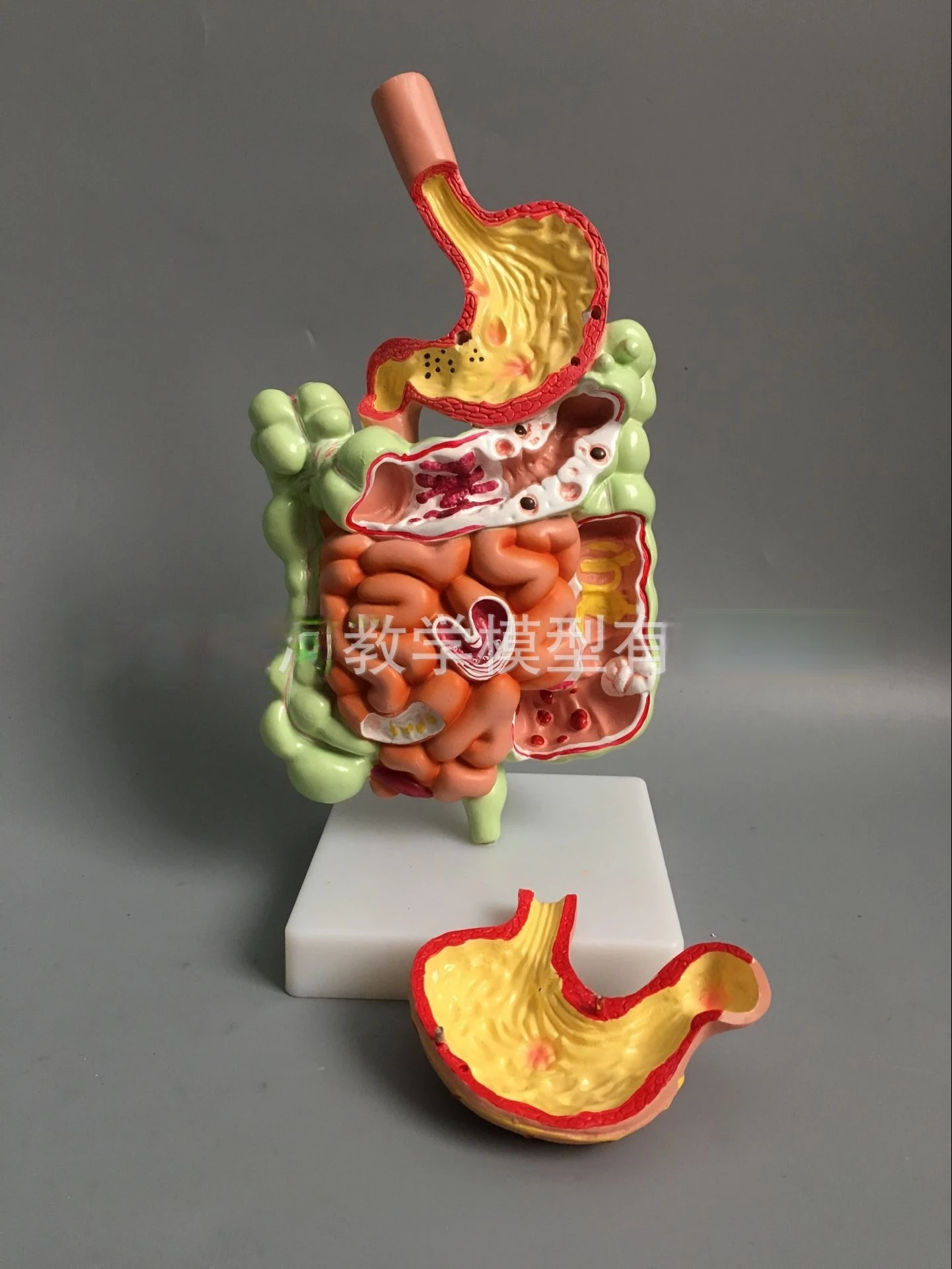 Human Digestive System Model Stomach Anatomy Large Intestine Cecum ...