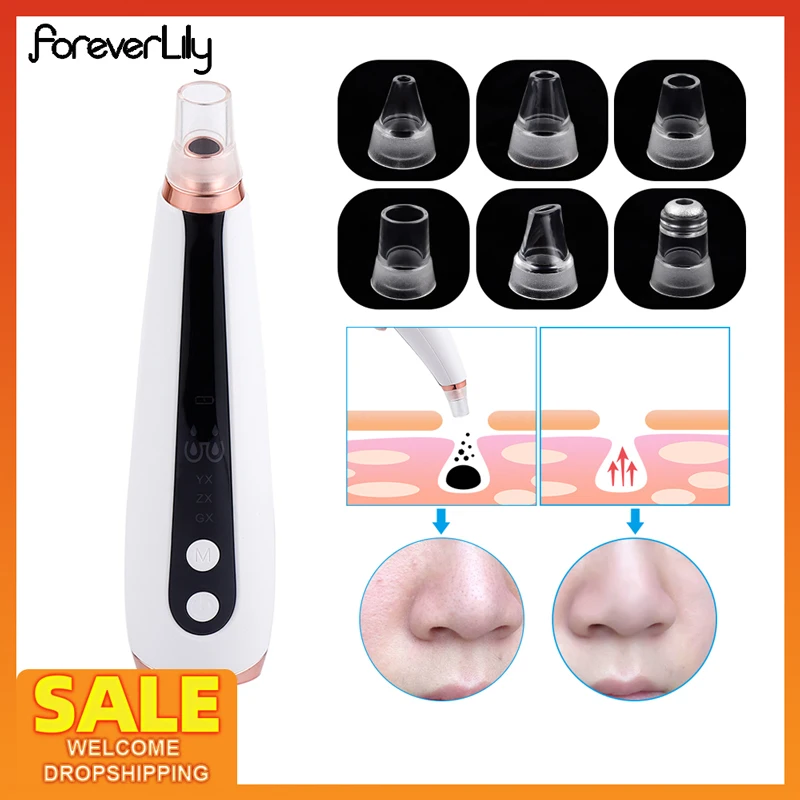 Zit Suction Tool