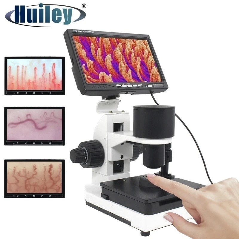400x Hd Color Digital Nailfold Capillary Microcirculation Instrument ...