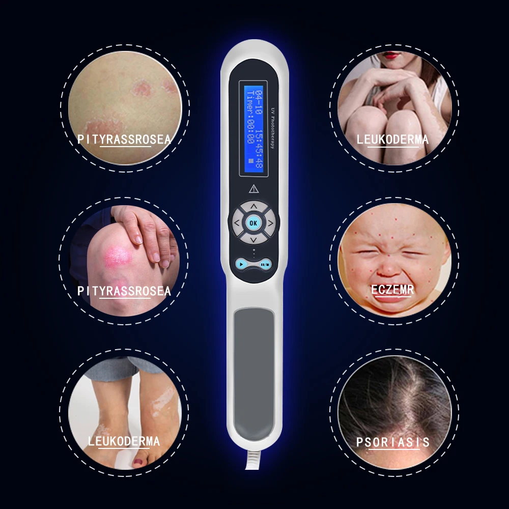 Uv Light Therapy Eczema