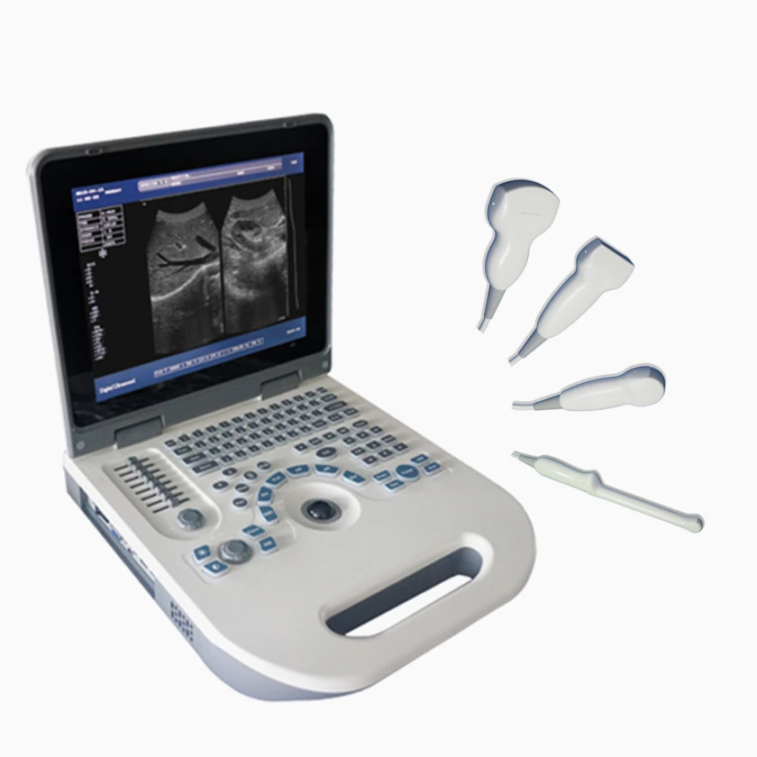 Upgrade-Good-Image-12-Inch-LED-Screen-Notebook-Ultrasound-USG-Scanner ...