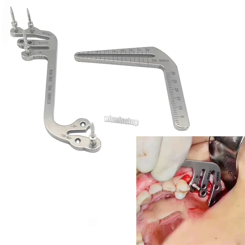 Dental-implant-instrument-oral-positioning-guide-guide-dental-implant ...