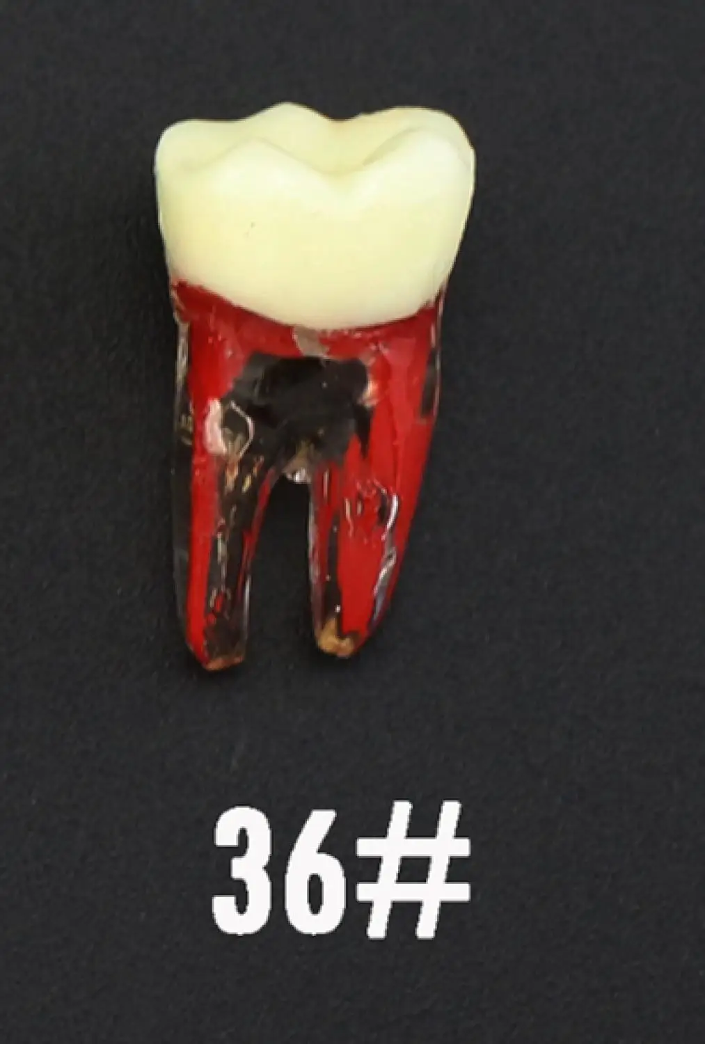 36# (ll6 First Molar) Dental Endo Root Canal Teeth Study Practice Model ...