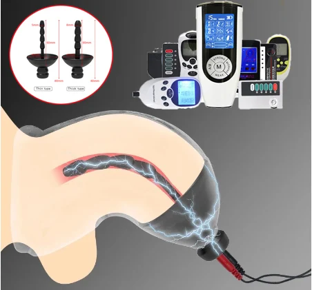 BDSM-Shock-Cock-Cage-E-Stim-Glans-Medical-Probe-Urethral.jpg