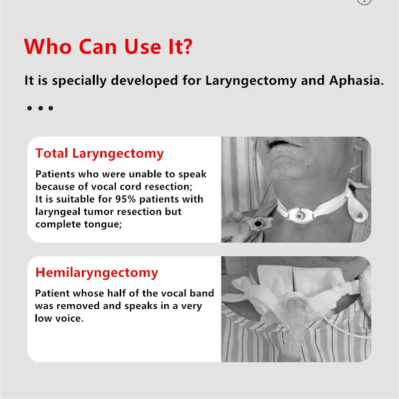 Hemilaryngectomy