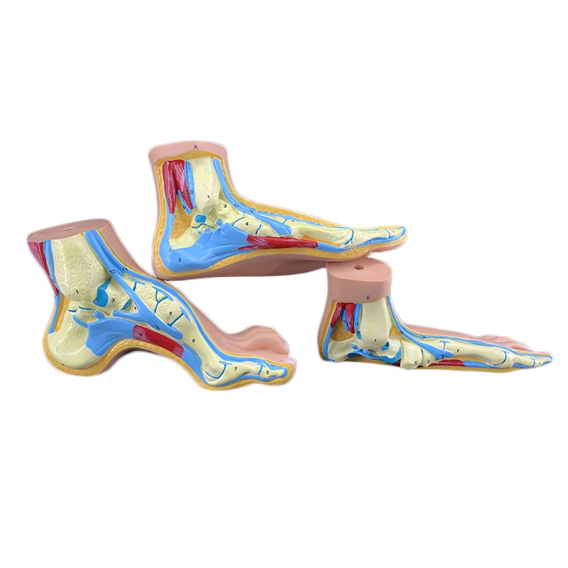 Normal-foot-Arch-foot-High-arch-foot-model-Foot-joint-model-Claw-foot ...