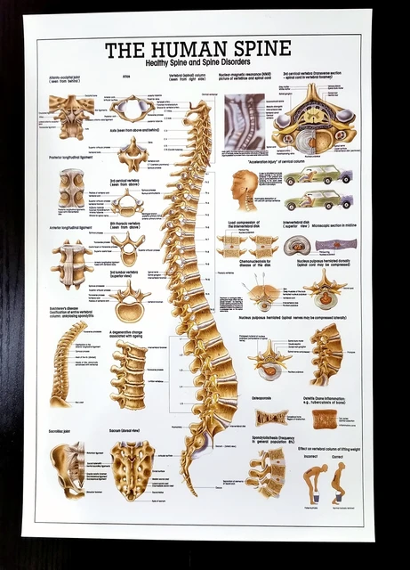 Human Spine Disorders
