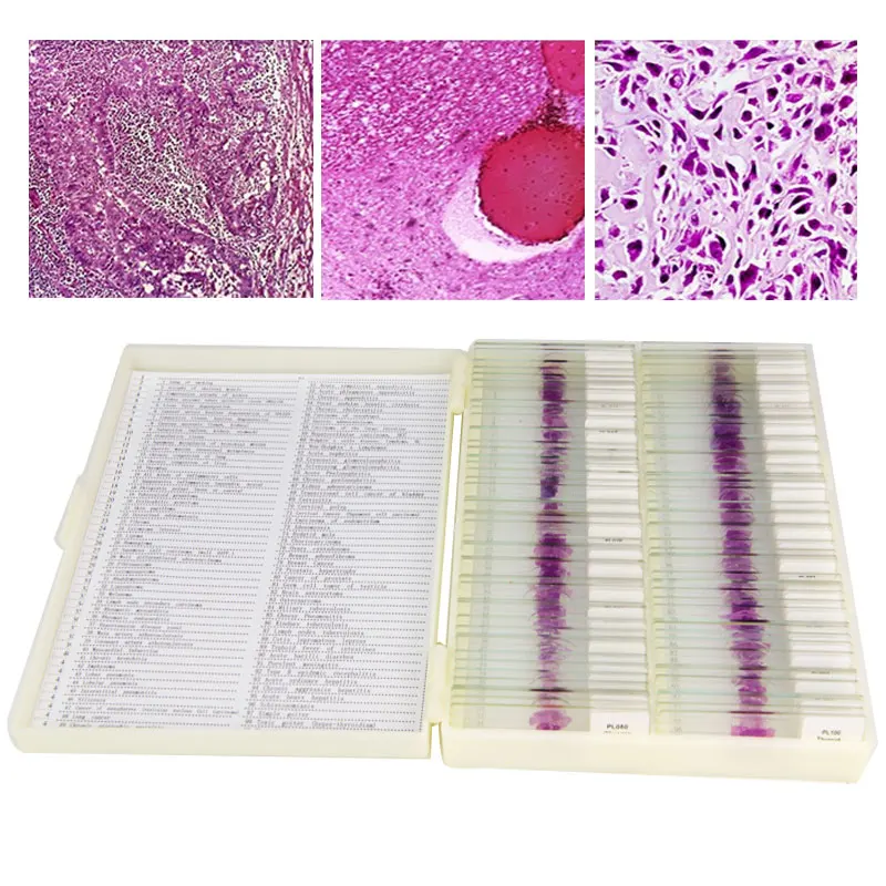 100PCS-Medical-Pathological-Sections-of-Human-Body-HE-Staining-Typical ...