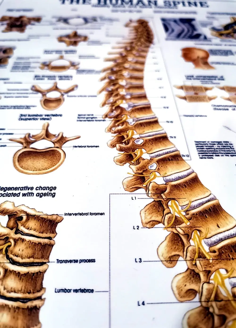 Human Spine Disorders