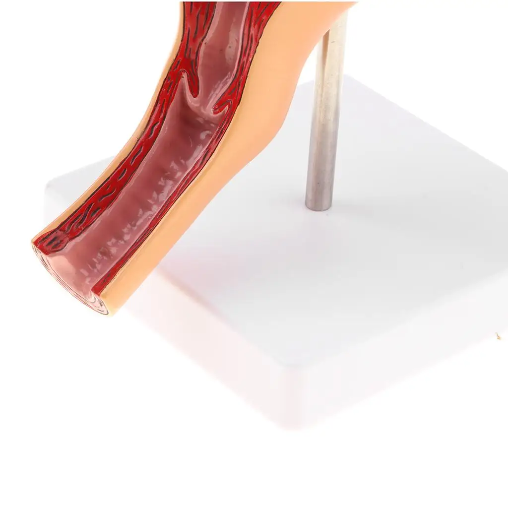 female Ovary and uterus disease Dissection model Pathology uterus model ...