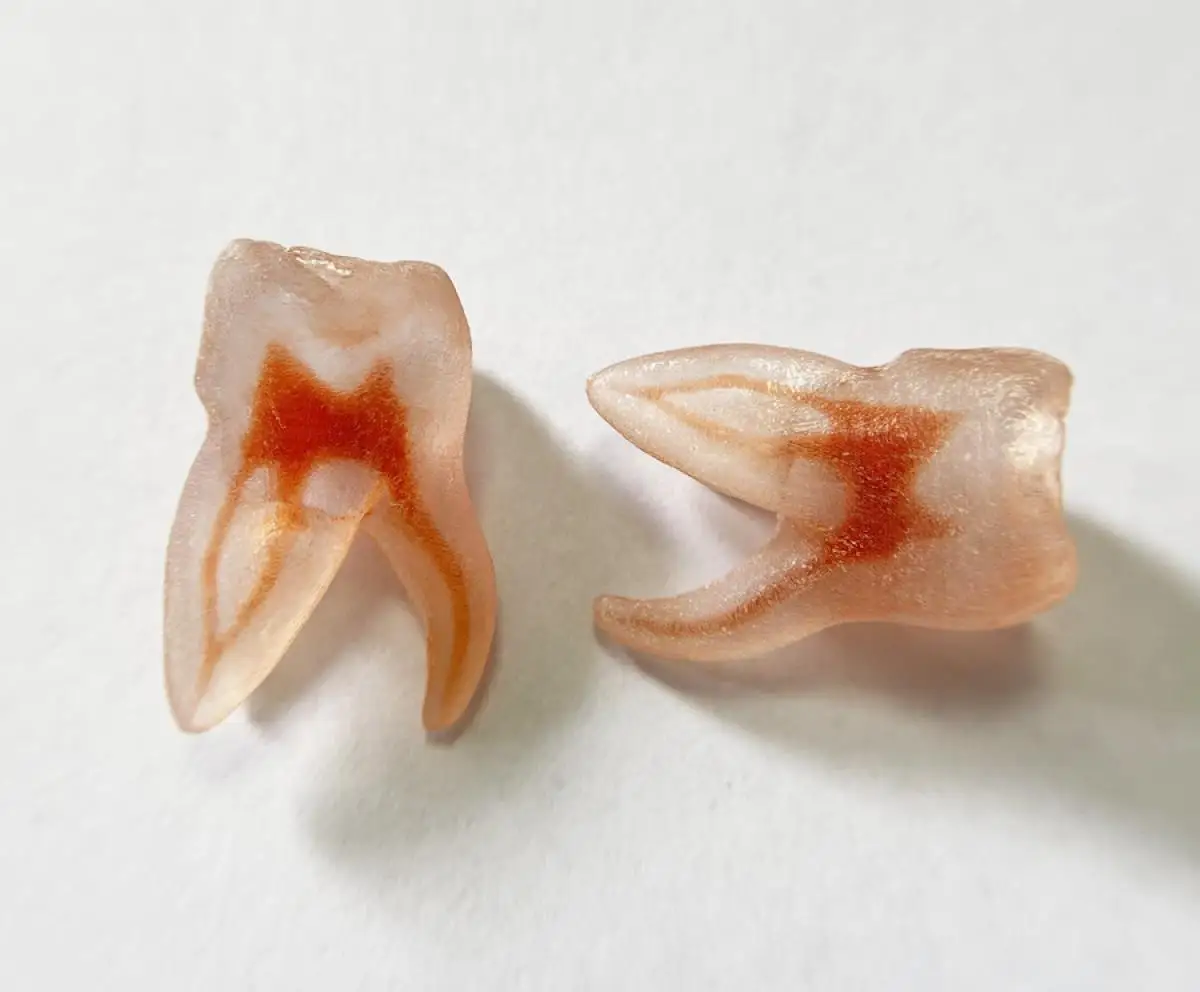 1pis-4pis-oberer-Molar-b-Z-hne-Zellstoff-Modell-roter-Wurzelkanal-Zahn ...