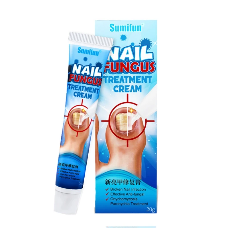 20g-Chinese-Herbal-Toe-Nail-Fungus-Treatment-Cream-Onychomycosis ...