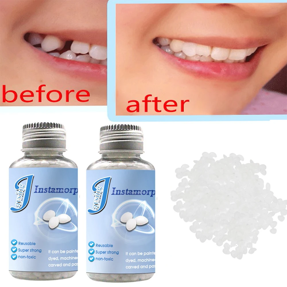 10/30ml Solid Denture Adhesive Glue Oral Cavity Temporary Tooth Filling ...