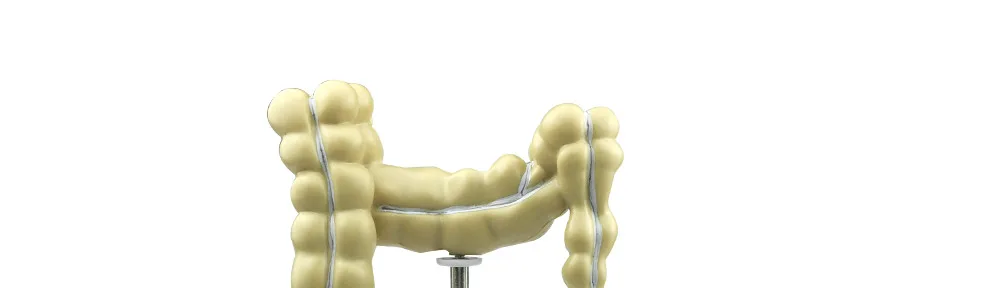 Colorectal Lesion Model Human Colon Snake Large Intestine Pathological ...