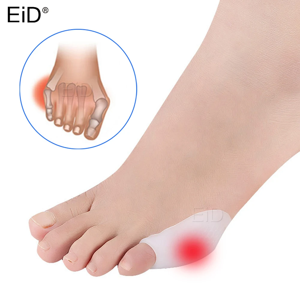 EiD 2 Pcs Silicone Gel Small Toes Separator Corrector Toe Orthotics ...