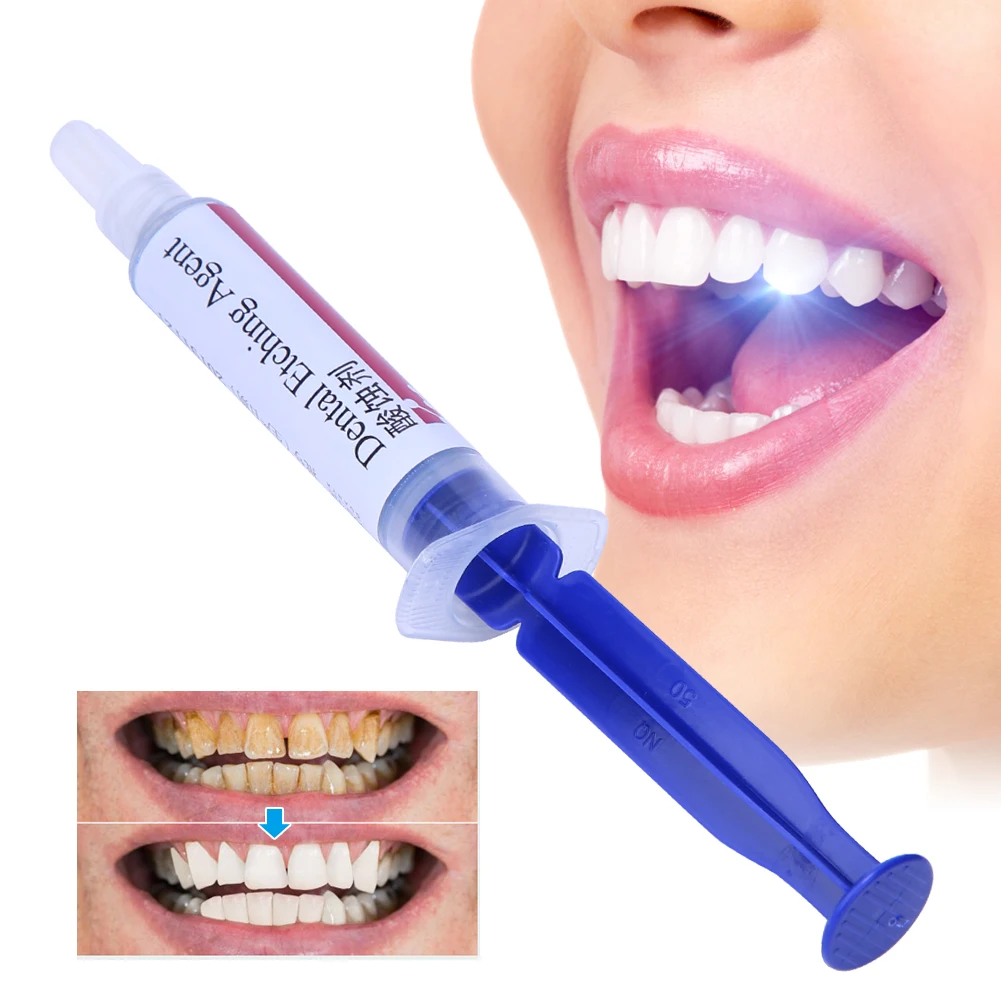 Dental Etching Agent 37% Phosphoric Acid Etch Polymer Thickened Semi-Gel Type Syringe Treat ...
