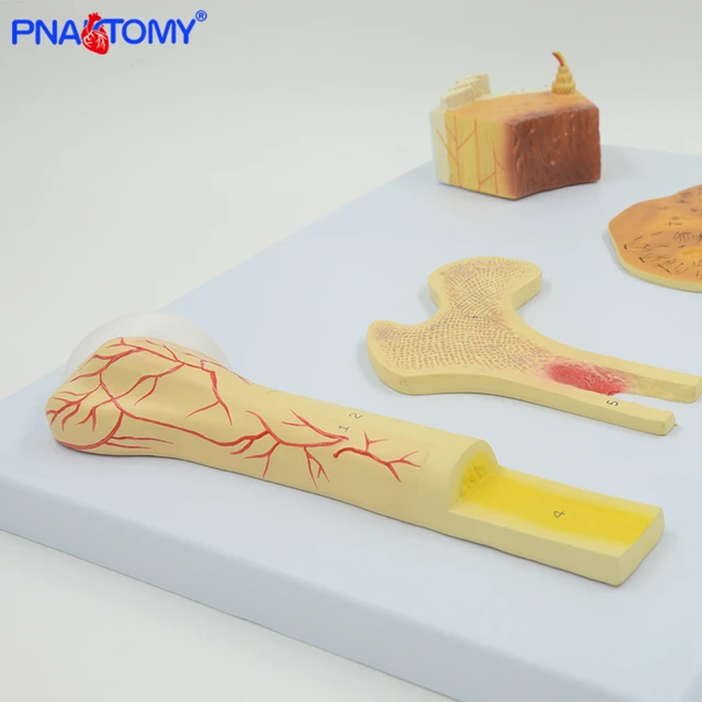Spongy Bone Model