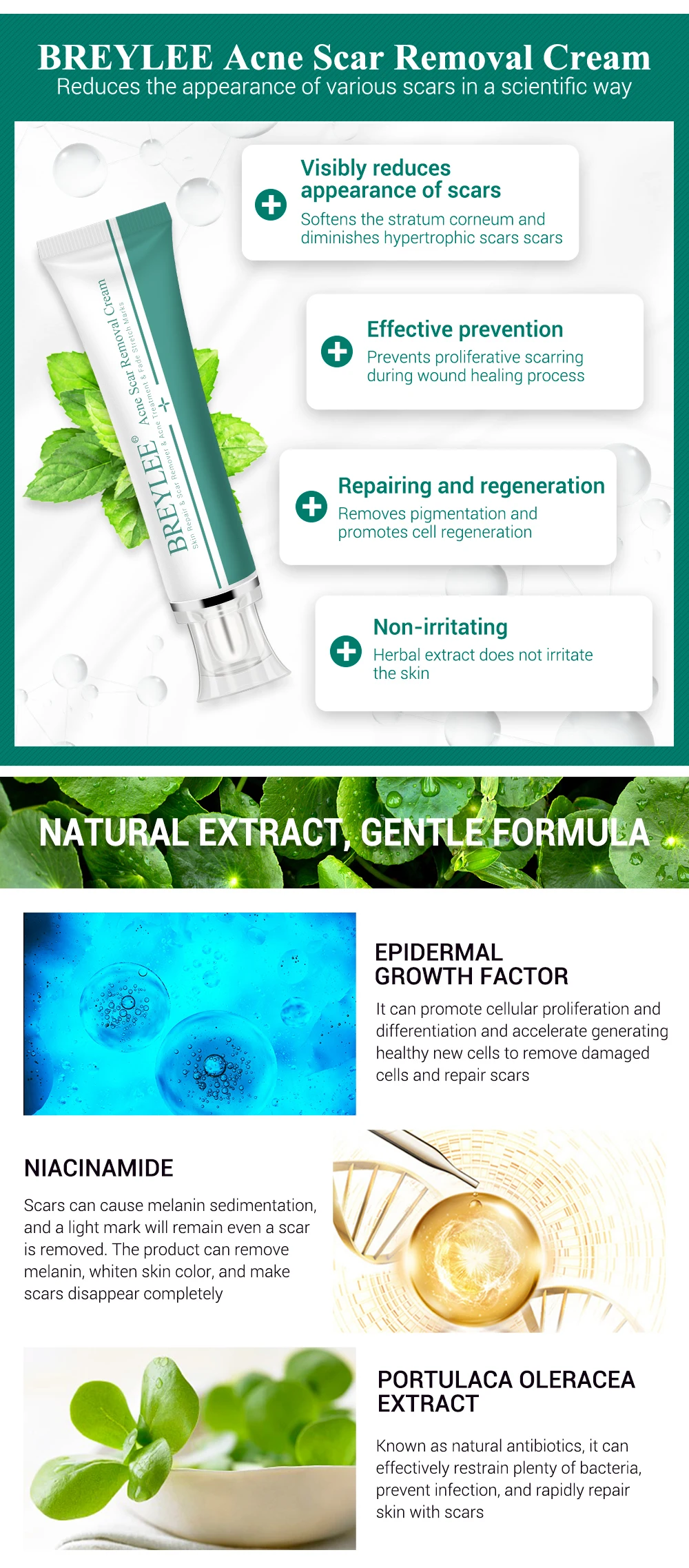 BREYLEE Acne Scar Removal Cream Skin Remove Stretch Marks Repair Skin Care Scar Acne Treatment ...