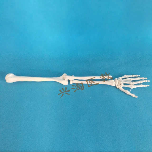Large Bone In Arm