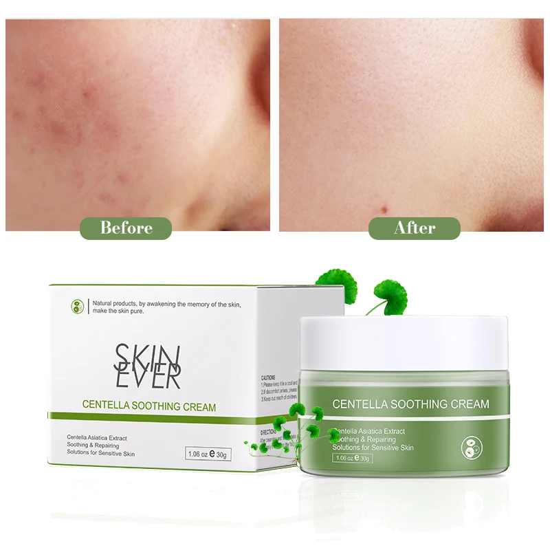 Centella Repair Face Cream Moisturizing Nourishing Anti Inflammatory ...