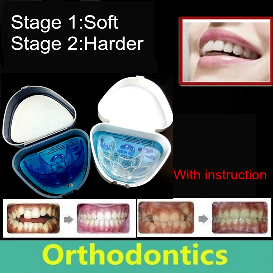 Adult Alignment Teeth Retainer Orthodontic Retainer Buck Teeth ...