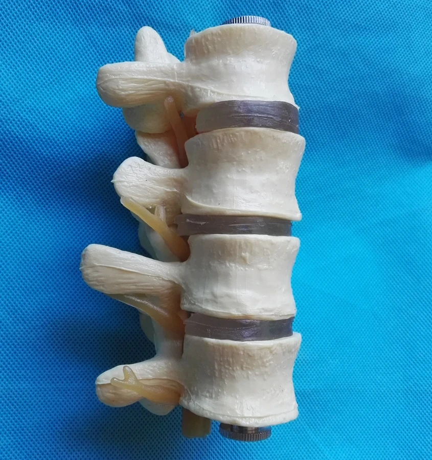 4-b-l-m-insan-lomber-Sketelon-Set-lomber-disk-herniasyon-g-steri-modeli ...