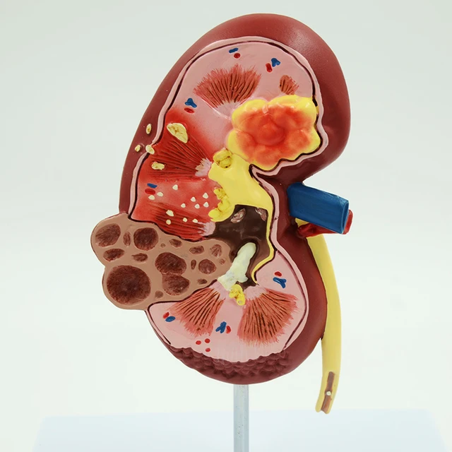 Internal Organs Kidney