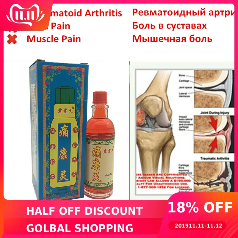 20ml Chinese shaolin tongkanglin Herbal Medicine Joint Pain Ointment ...