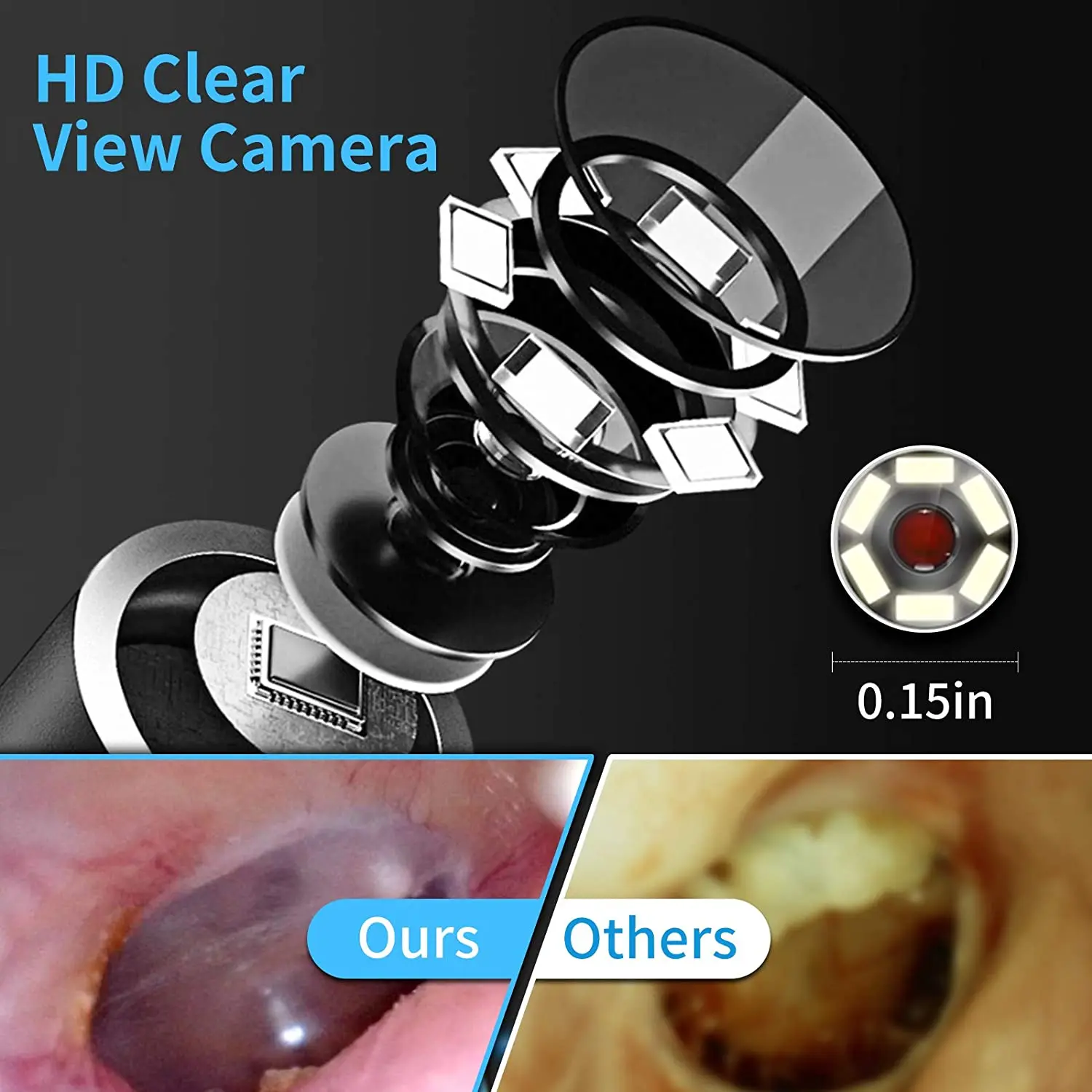 Otoscope View Ear Wax