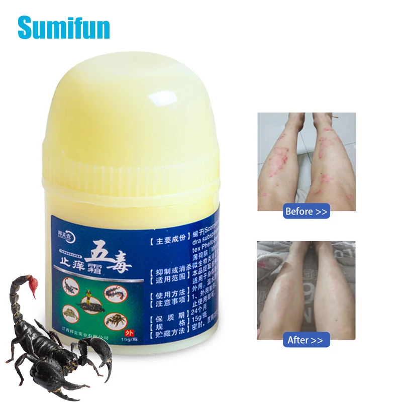 15g-Scorpion-Venom-Dermatitis-Treatment-Ointment-Antifungal-Eczema ...