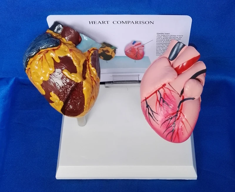Unhealthy Heart From Smoking