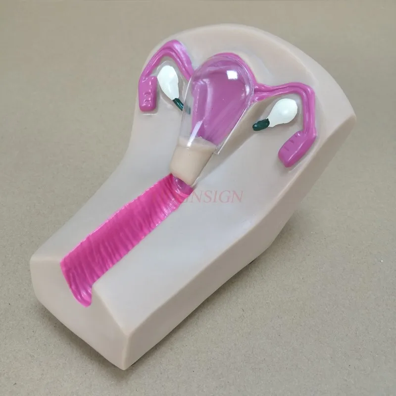 intrauterine-device-Female-intrauterine-contraceptive-device-and ...