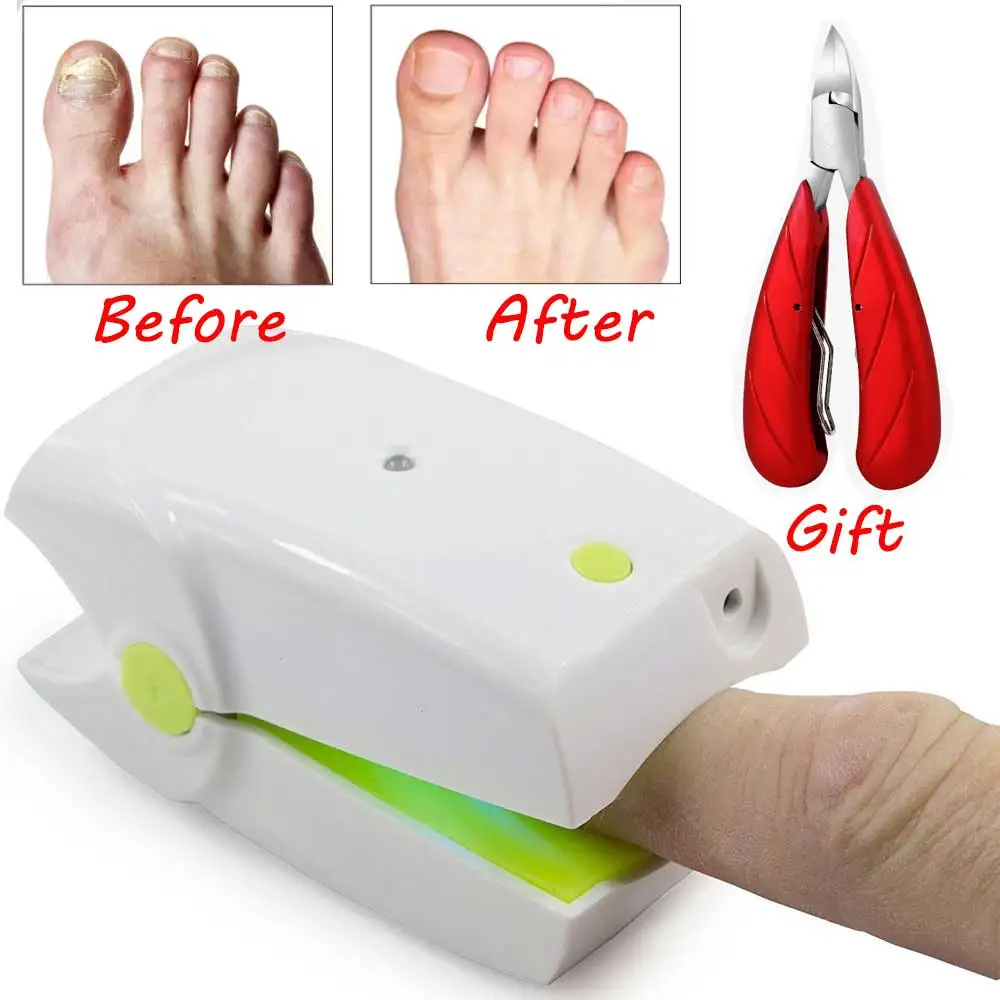 Painless Nail Fungus Cold Laser Treatment Device Nail Fungus Removal ...