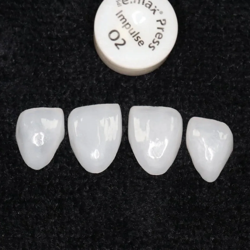 Geen. 41 #2Pcs Tanden Fineer Tand Whitening Tandheelkundige Keramische ...