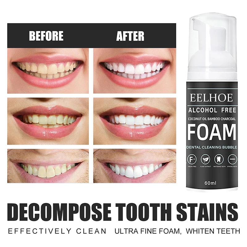 Coconut Oil Before And After Teeth