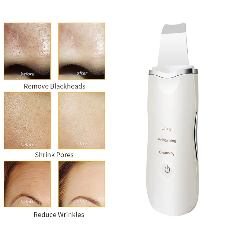 Skin Purifier Ultrasonic Skin Scrubber Beauty Instrument Device Remove ...