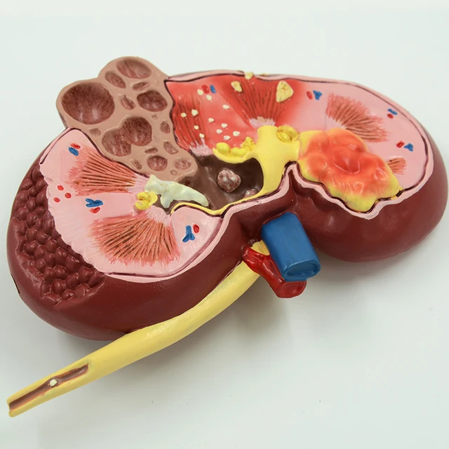 Internal Organs Kidney
