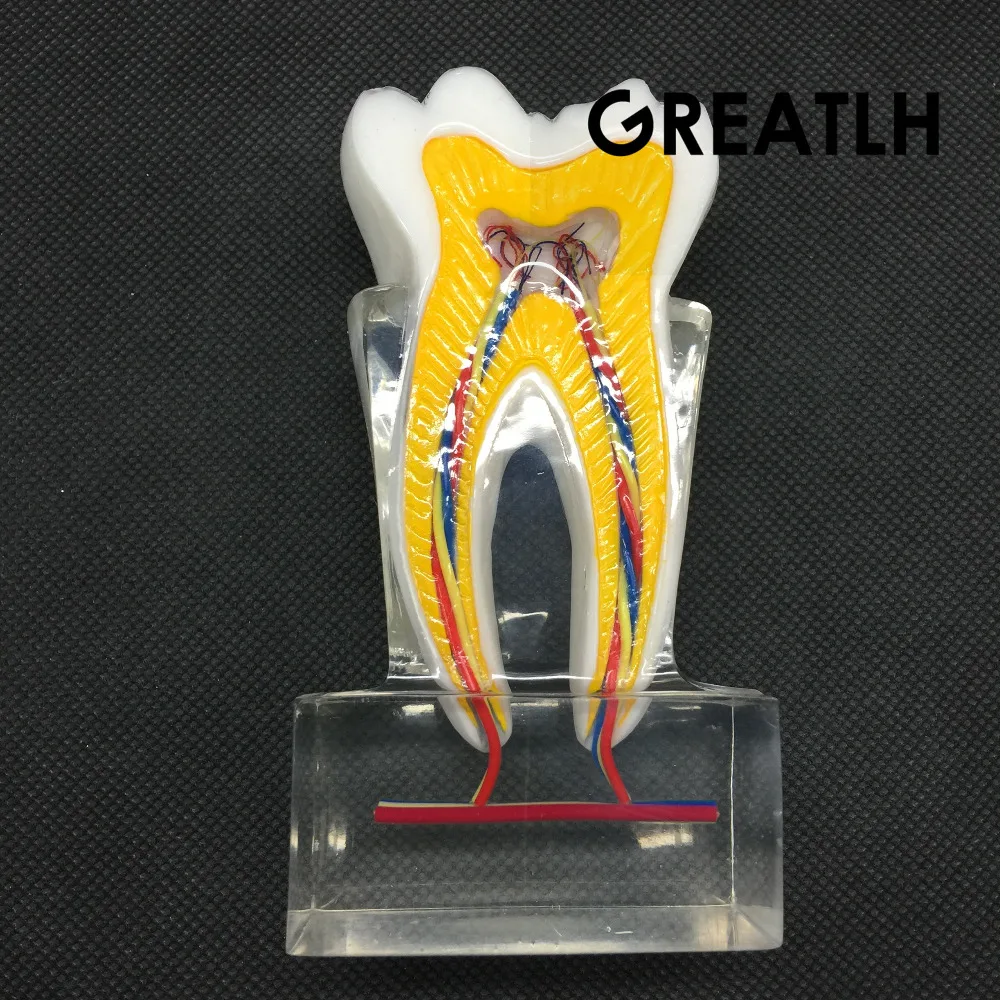 Dental Anatomical Molar Model 2017 Molar Inner Structure With Nerves ...