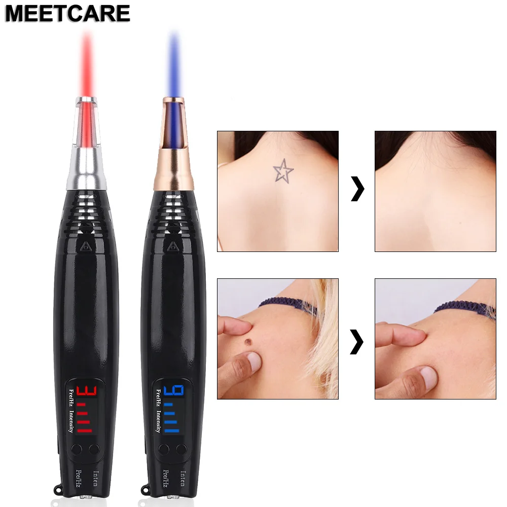Led 흉터 문신 제거 레이저 펜 주근깨 여드름 점 다크 스팟 안료 문신 제거 뷰티 머신 프로 수리 피코세컨드 펜 미용기기