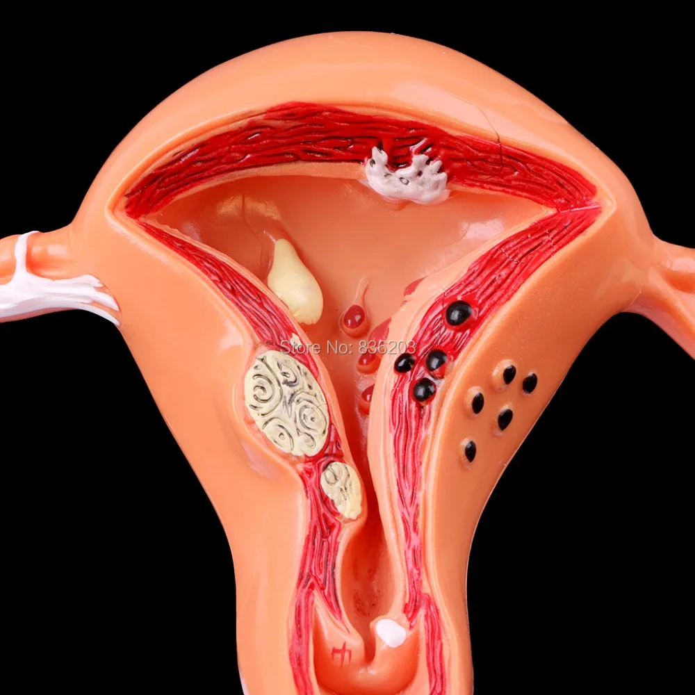 Real Ovary