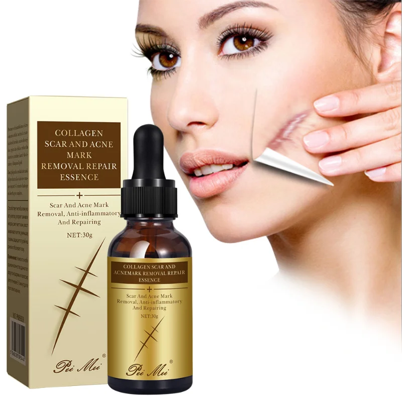 Collagen Scar Repair Essence Nourish Smooth Scar Moisturizing Anti-Acne ...