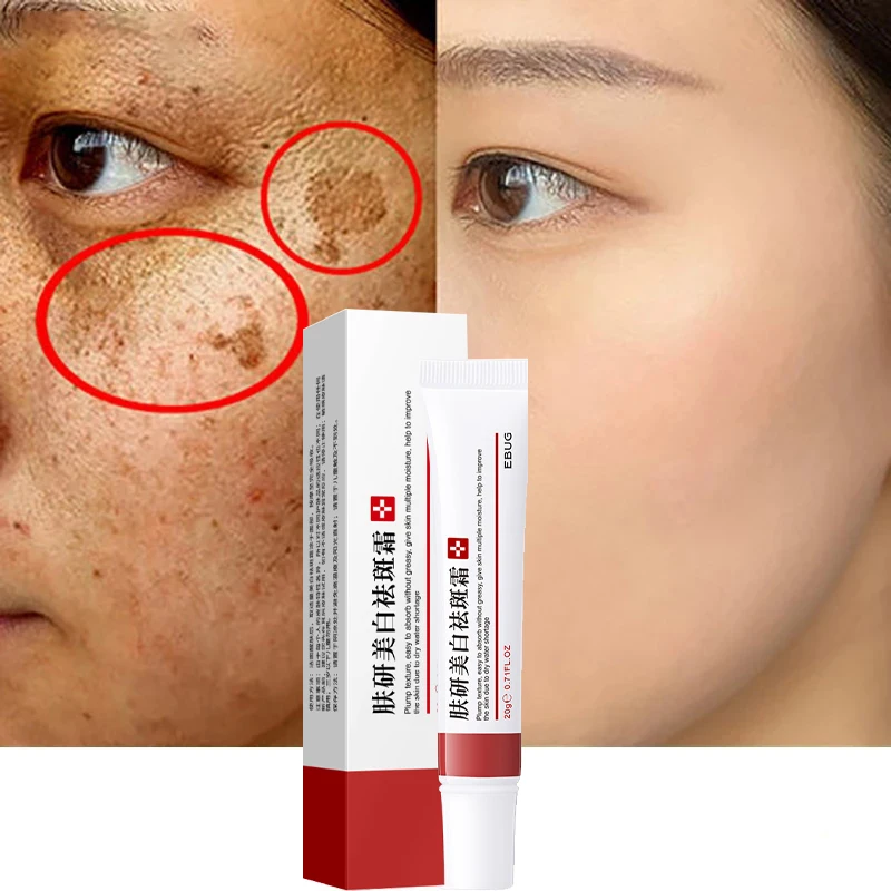 미백 주근깨 크림 기미 제거 크림 다크 스팟 제거 멜라닌 기미 제거제 브라이트닝 스킨 안티 에이징 피부 라이트닝