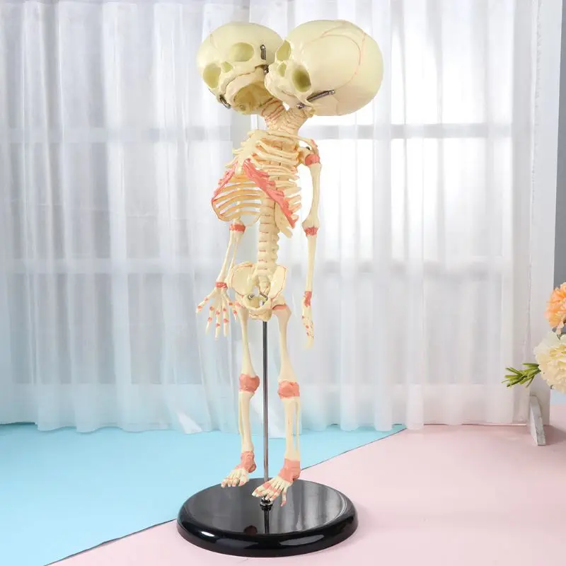 Promo 37cm Human Double Head Baby Skull Skeleton Anatomy Brain Display ...