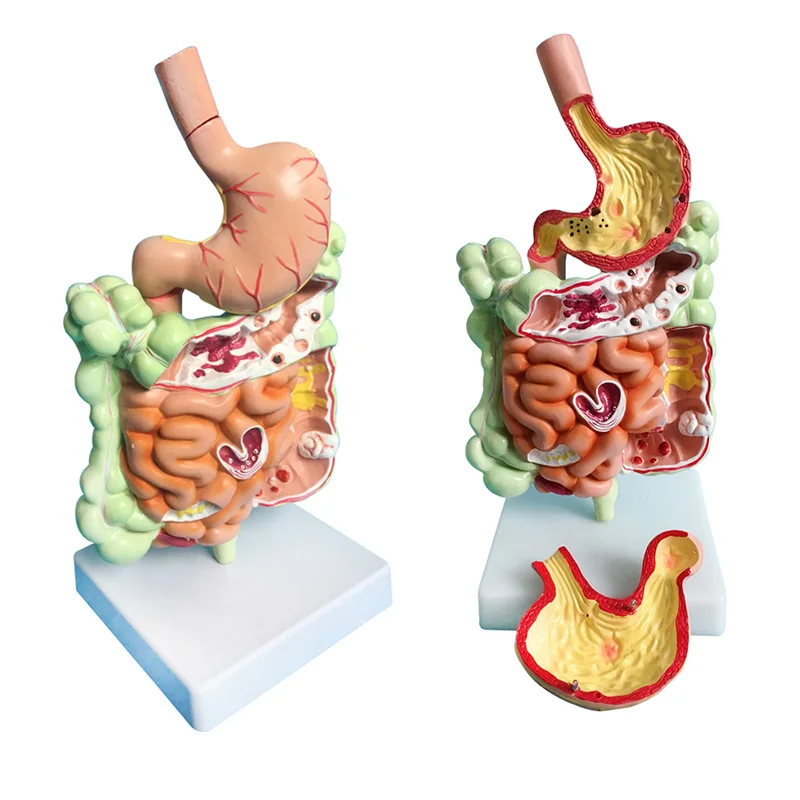 Modello-di-sistema-digestivo-umano-anatomia-dello-stomaco-intestino ...