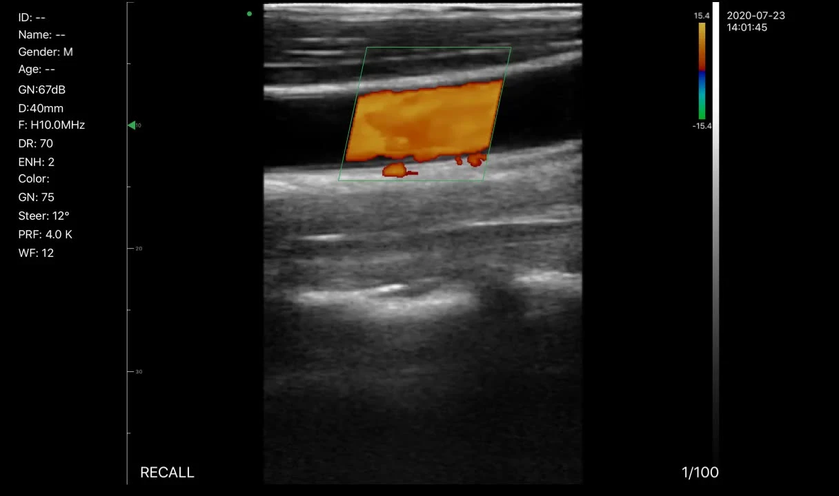 Konted 5g canal ecográfico wifi & usb cabeça dupla c10rl 3 em 1 ...