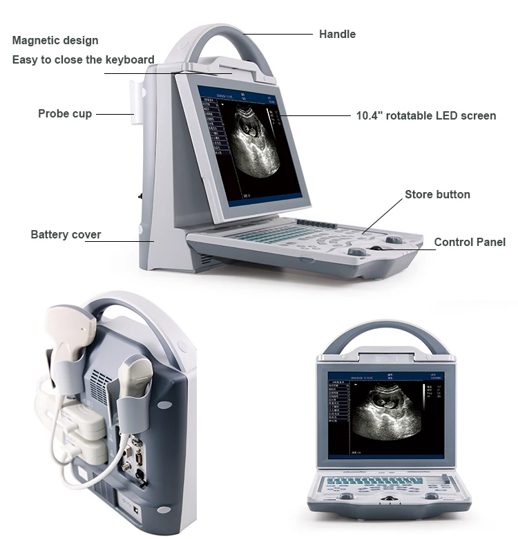 Ultrasound Machine Diagram