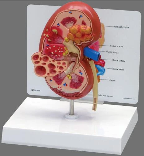 The Nephron Model